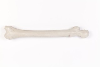 Lab-Grown Bones Were Just Successfully Implanted