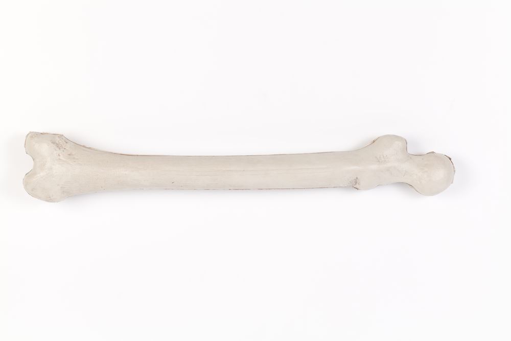 Lab-Grown Bones Were Just Successfully Implanted